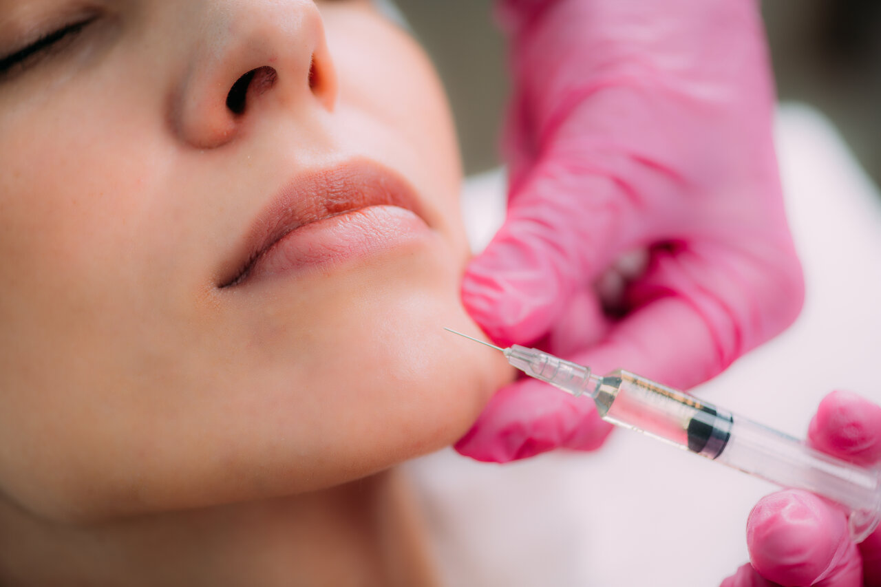 Expert Dermal Fillers NYC | Discover the Magic