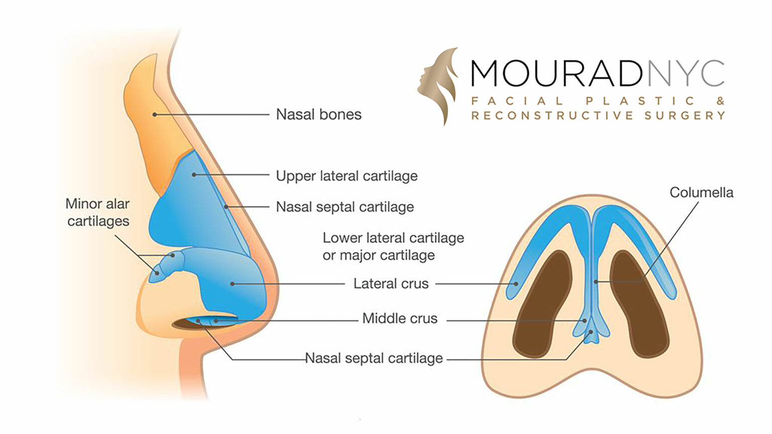 VivAer® Nasal Airway Remodeling | Unlock Effortless Breath